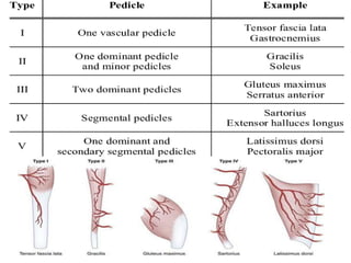 Classification of flaps | PPTX