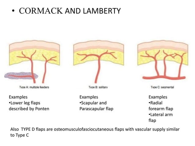 Classification of flaps | PPTX