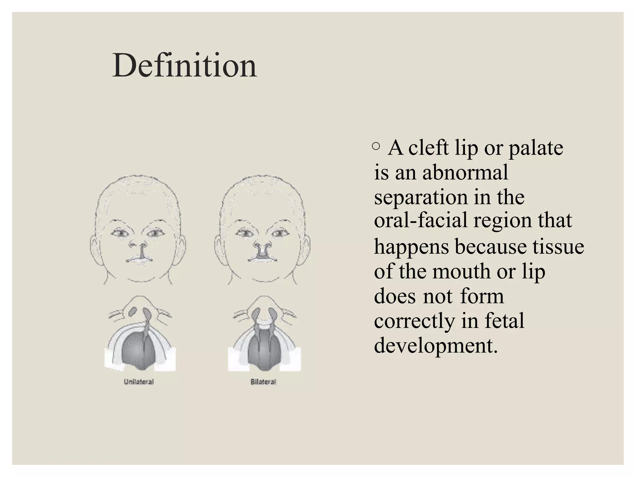 PPT_Cleftlip cleft palate_GI.pptx