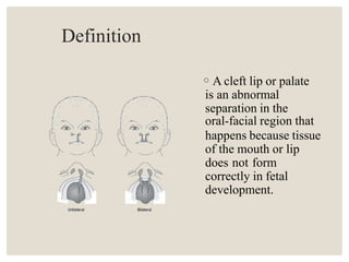 PPT_Cleftlip cleft palate_GI.pptx