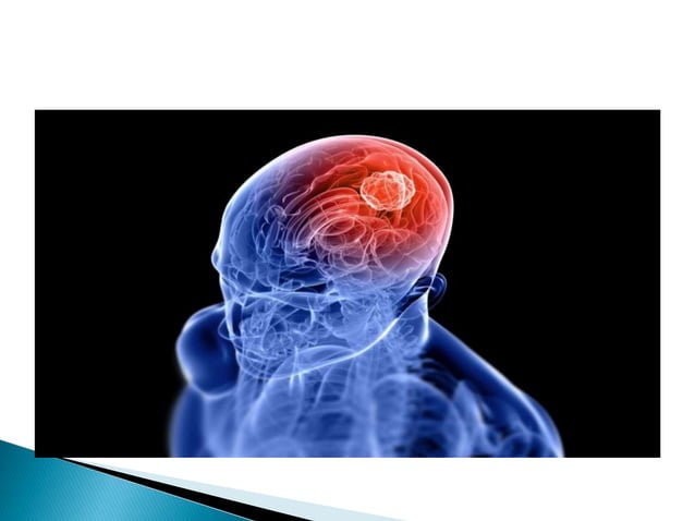 PPT_COMMON DISEASES OF NERVOUS SYSTEM.pptx
