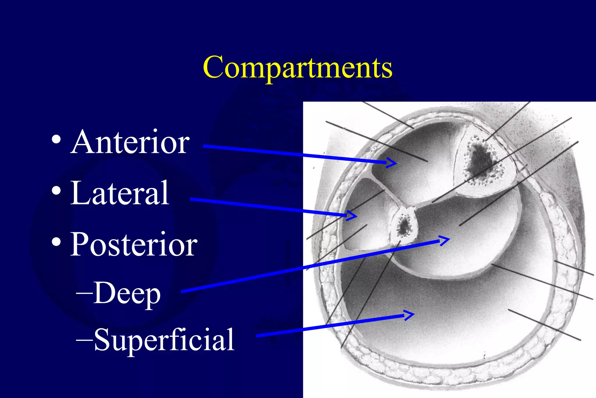 compartment syndrome | PPT