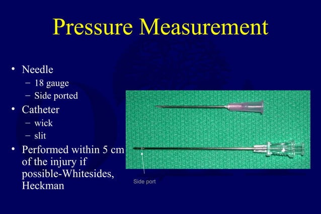 compartment syndrome | PPT