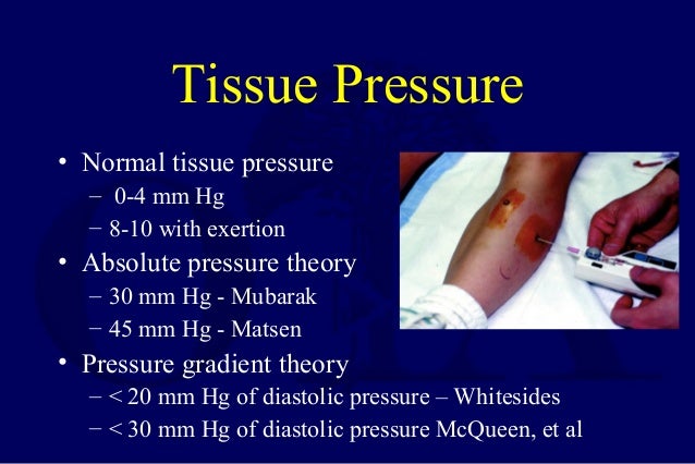 compartment syndrome