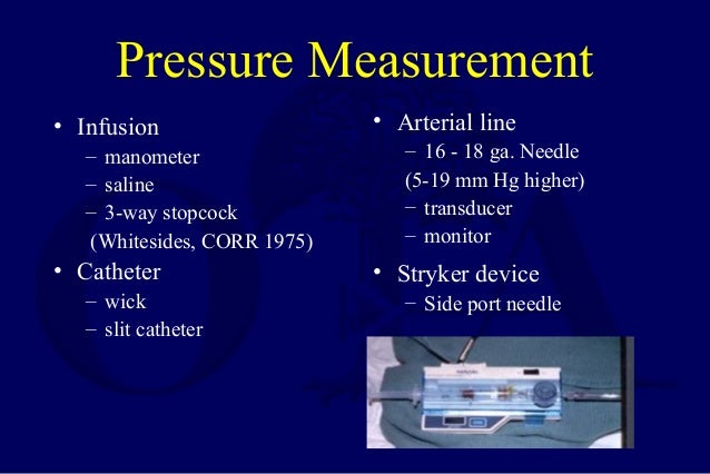 compartment syndrome