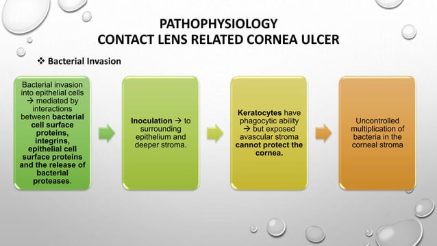Ppt contact lens induced corneal ulcer | PPT