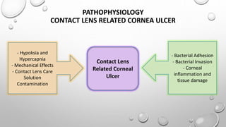 Ppt contact lens induced corneal ulcer | PPTX