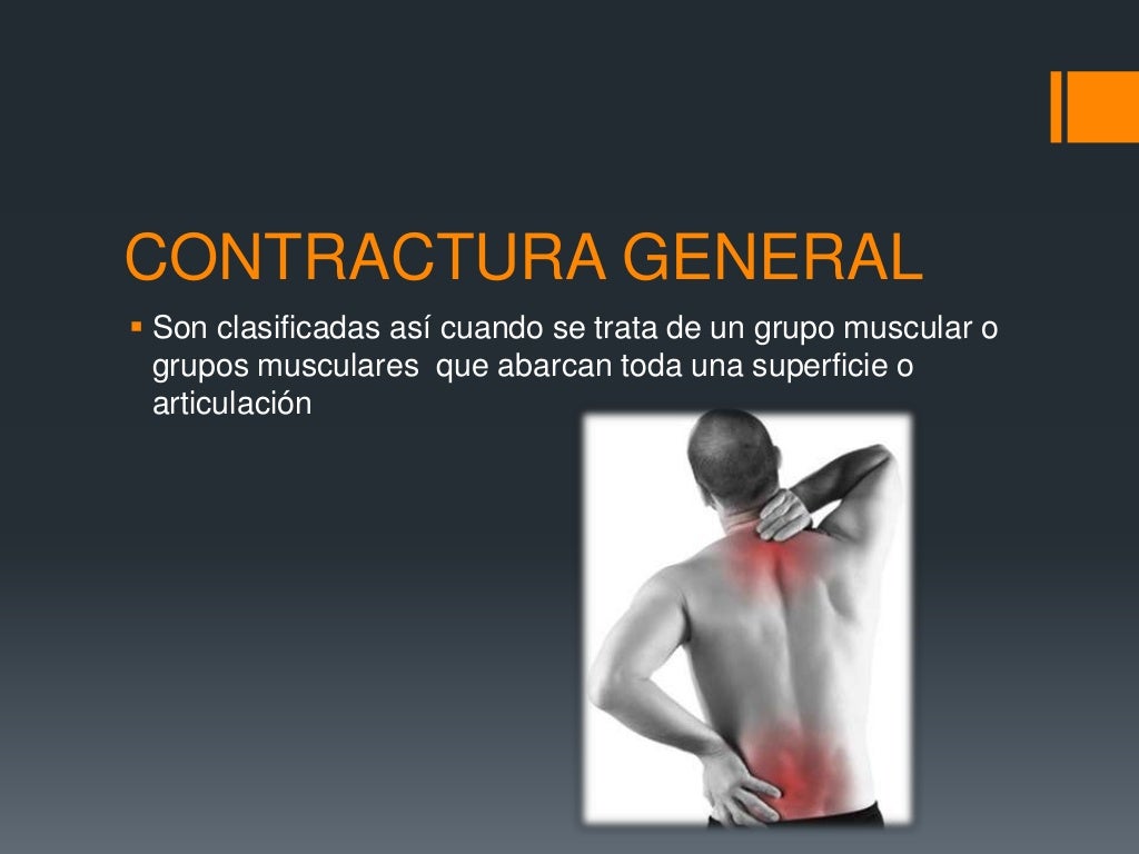 Contracturas