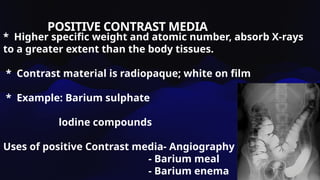Presentation on the topic of contrast media | PPTX