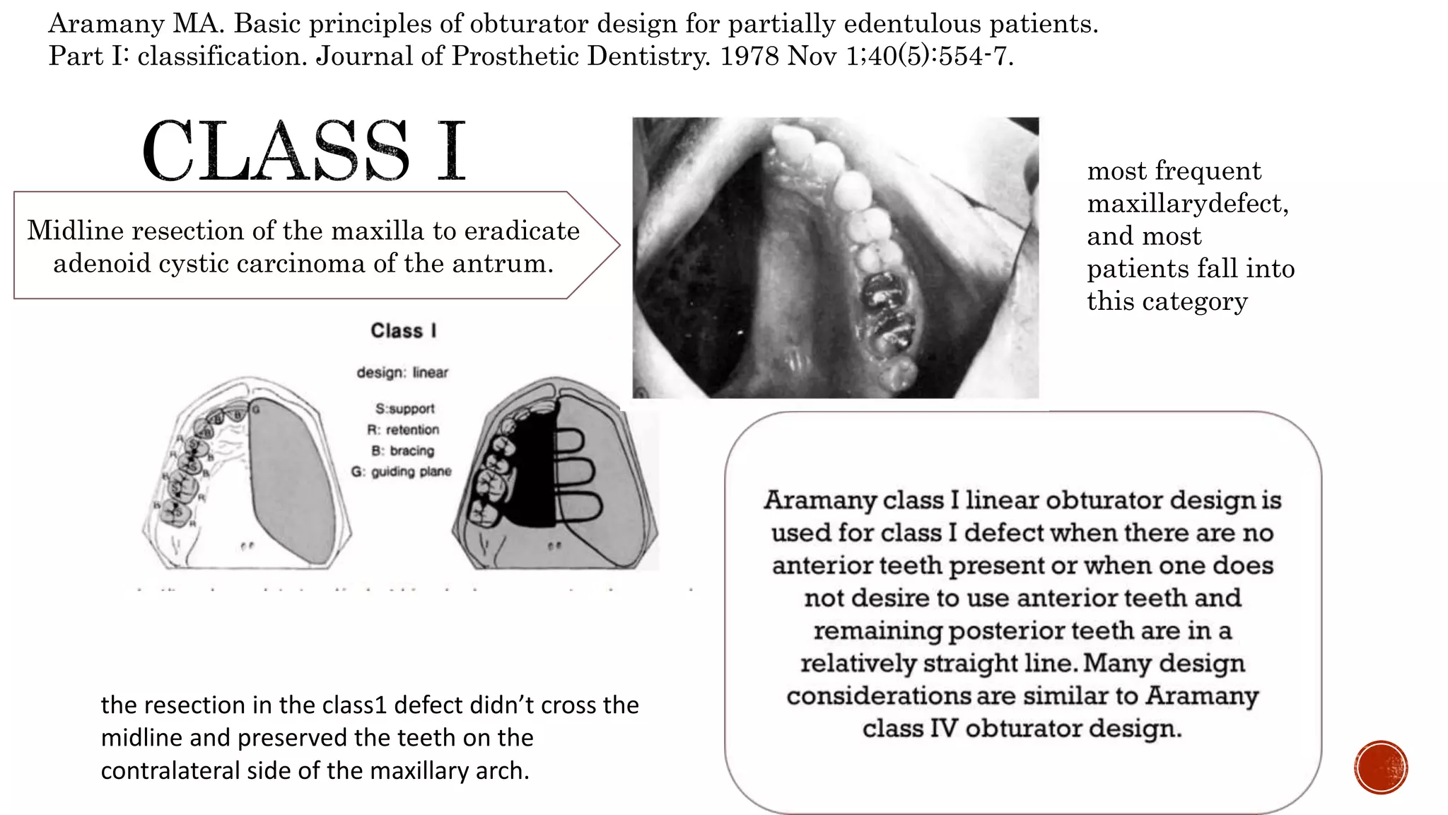 PROSTHODONTIC MANAGEMENT OF MAXILLECTOMY AND MANDIBULECTOMY PART 1 | PPTX