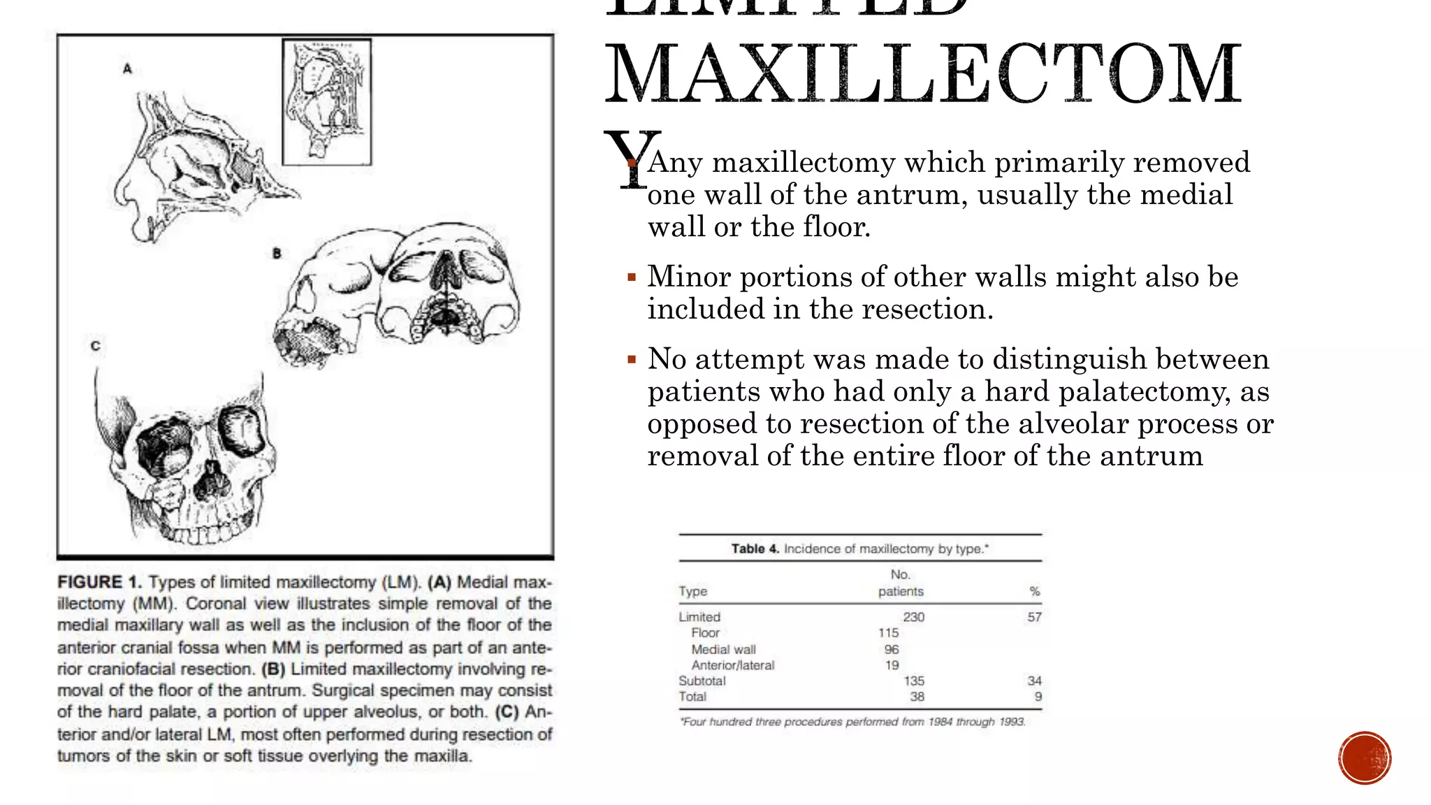 PROSTHODONTIC MANAGEMENT OF MAXILLECTOMY AND MANDIBULECTOMY PART 1 | PPTX