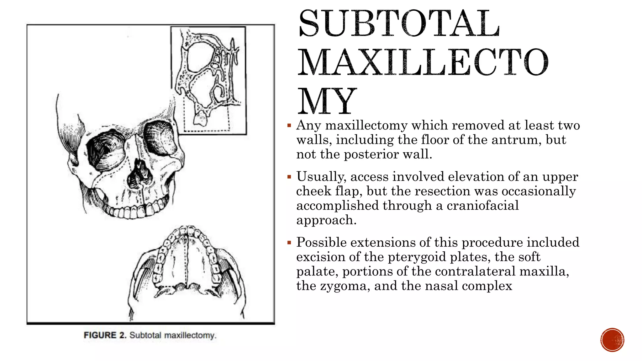 PROSTHODONTIC MANAGEMENT OF MAXILLECTOMY AND MANDIBULECTOMY PART 1 | PPTX