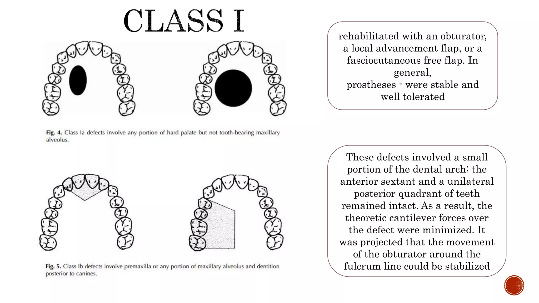 PROSTHODONTIC MANAGEMENT OF MAXILLECTOMY AND MANDIBULECTOMY PART 1 | PPTX