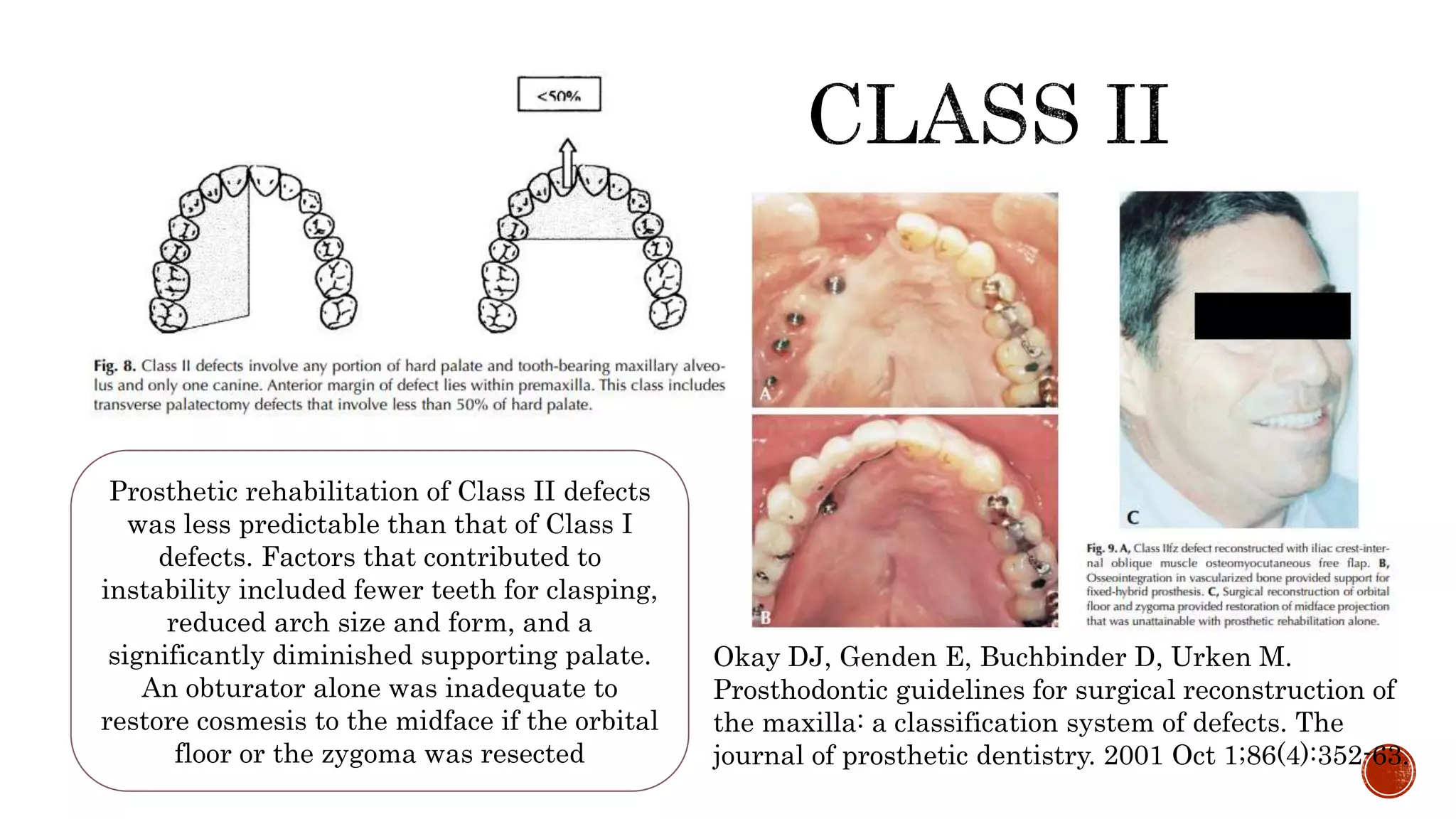 PROSTHODONTIC MANAGEMENT OF MAXILLECTOMY AND MANDIBULECTOMY PART 1 ...