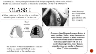 PROSTHODONTIC MANAGEMENT OF MAXILLECTOMY AND MANDIBULECTOMY PART 1 | PPTX