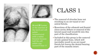 PROSTHODONTIC MANAGEMENT OF MAXILLECTOMY AND MANDIBULECTOMY PART 1 | PPTX