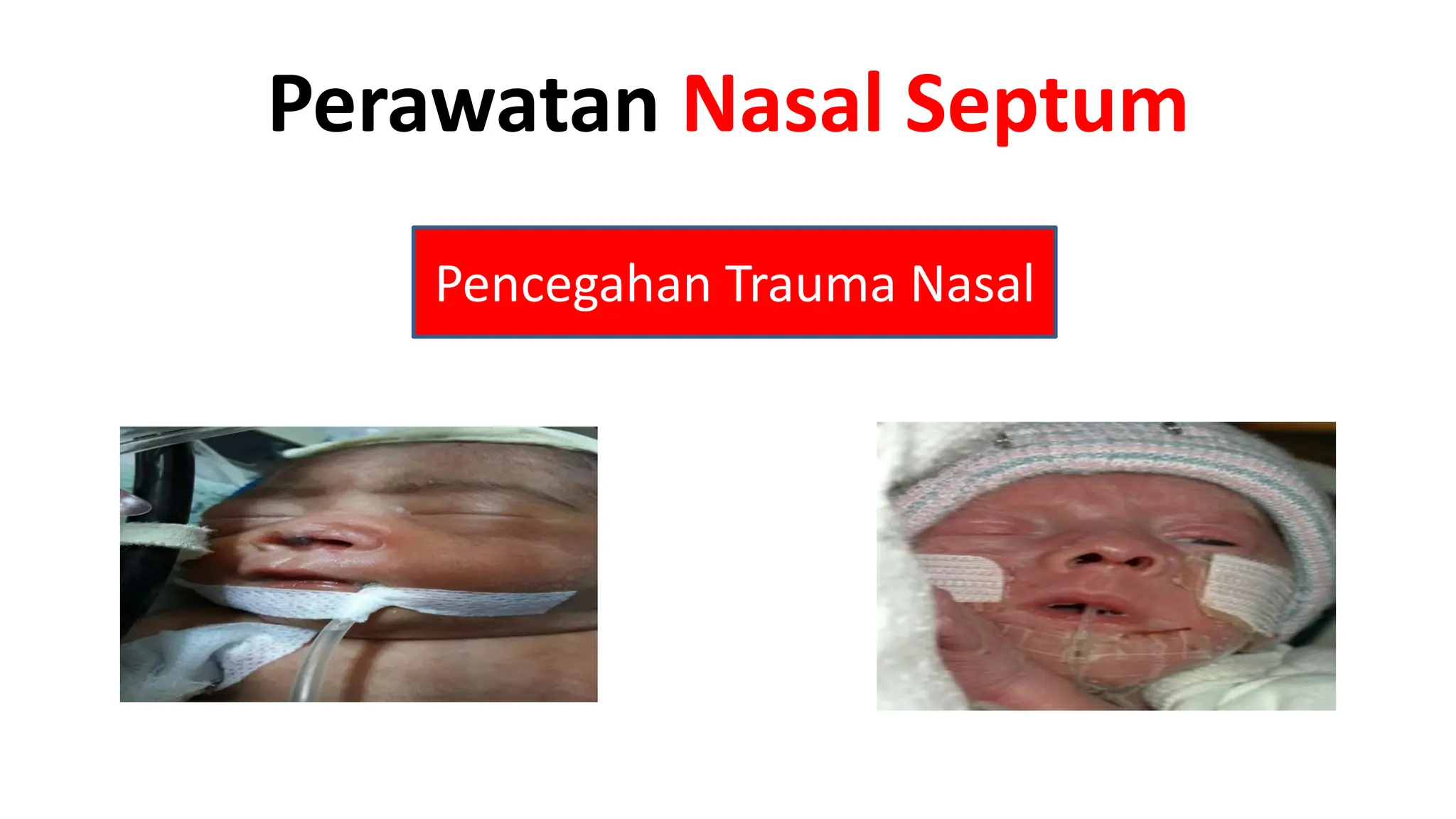 pengertian cpap itu adalah alat yang digunakan untuk | PDF