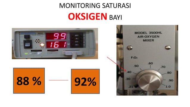 pengertian cpap itu adalah alat yang digunakan untuk | PDF