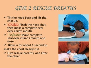 Pediatric CPR | PPTX