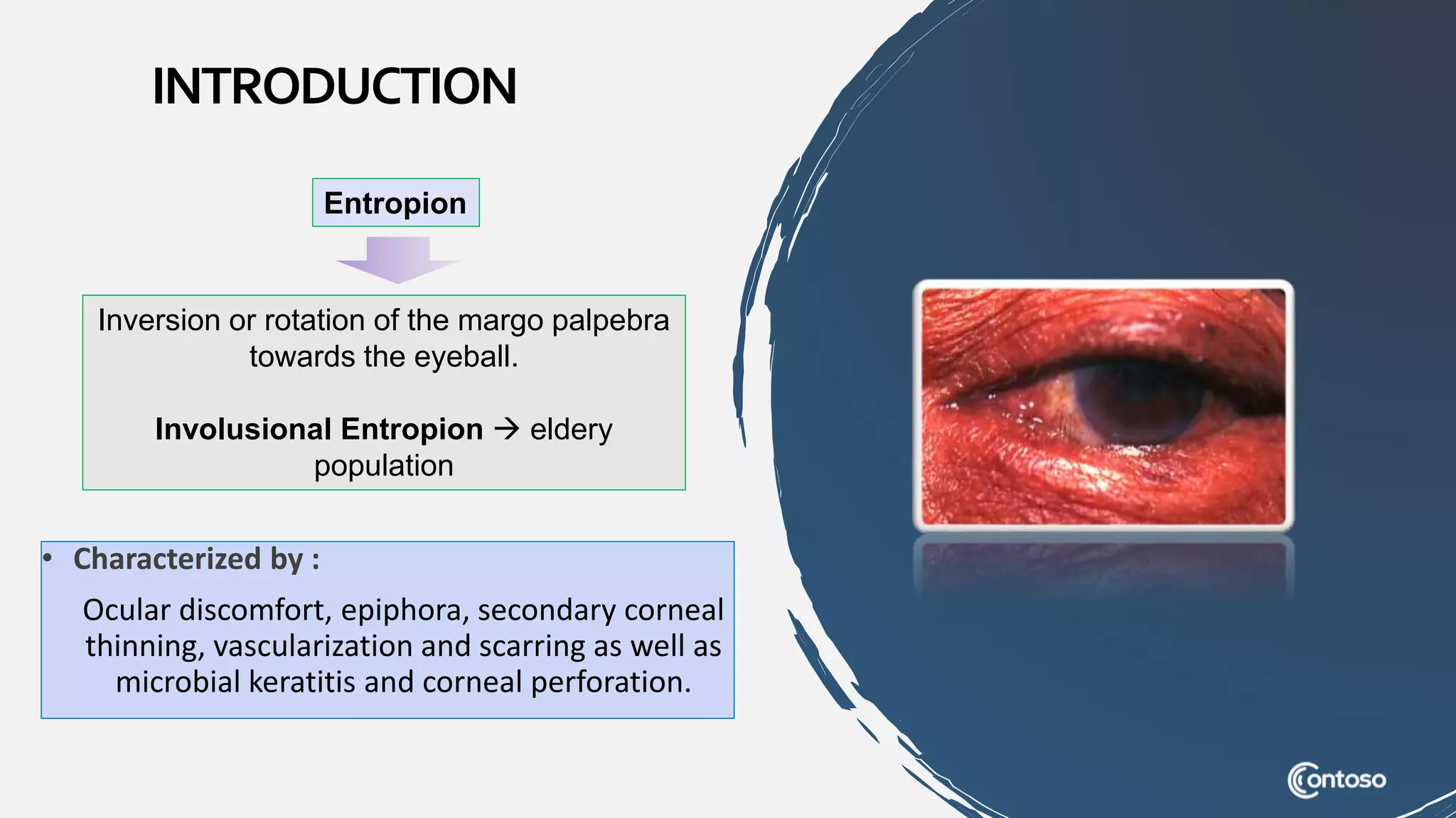 A Comparison of The Lateral Tarsal Strip with Everting Sutures and The ...
