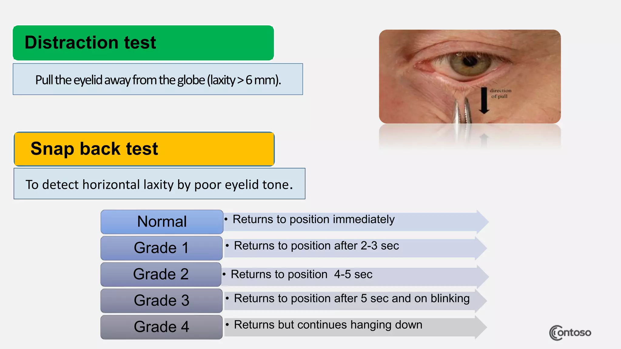 A Comparison of The Lateral Tarsal Strip with Everting Sutures and The ...