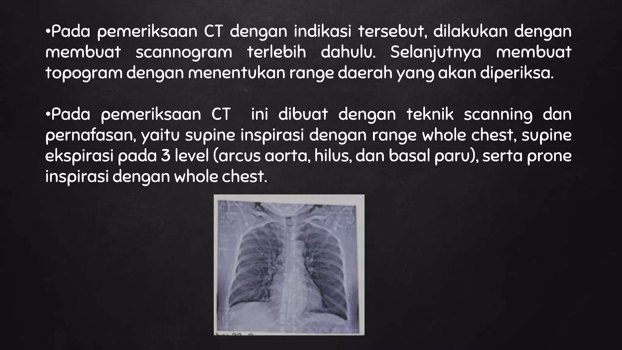 Ppt ct scan thorax pada kasus asma | PPTX