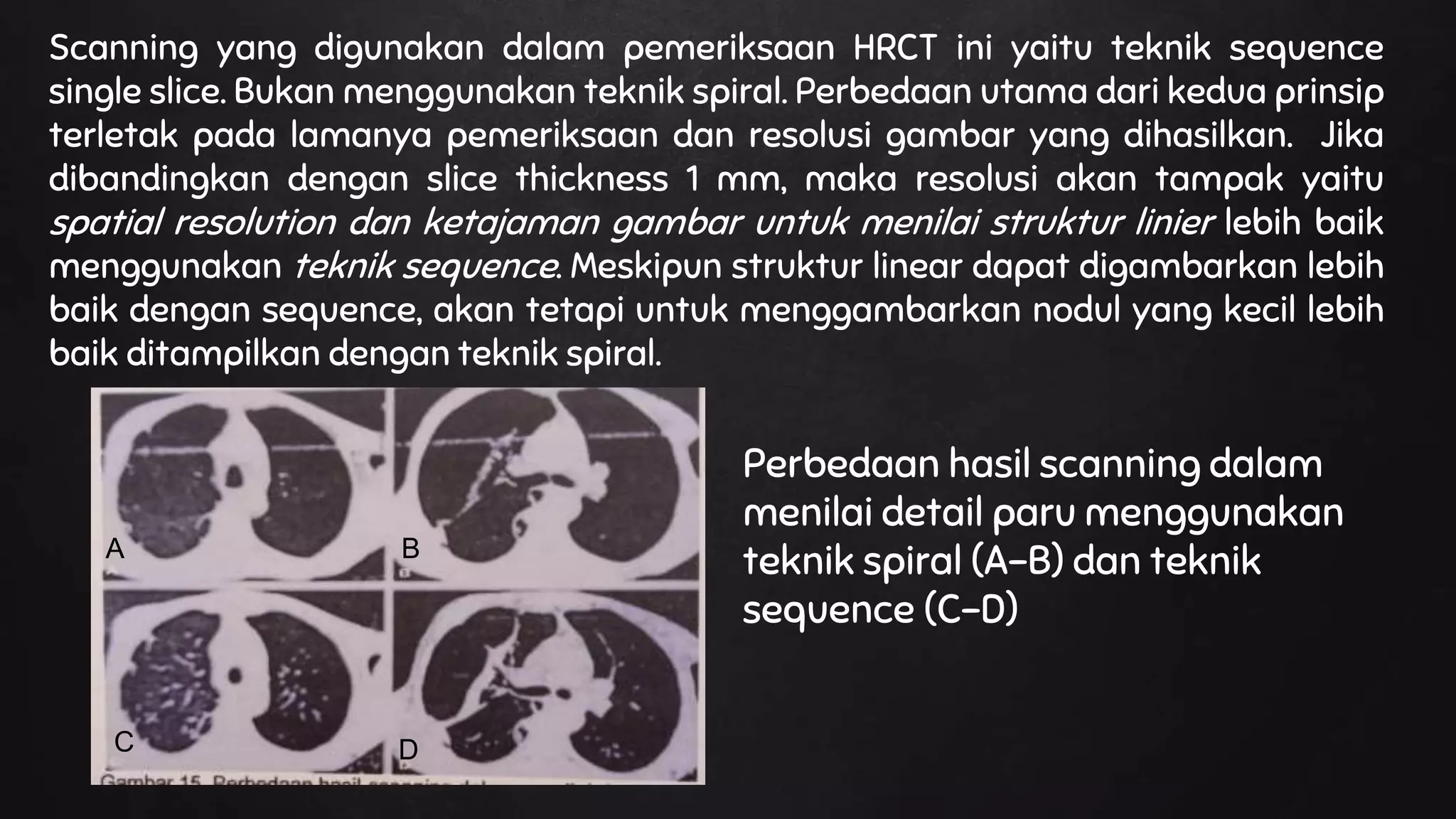 Ppt ct scan thorax pada kasus asma | PPTX