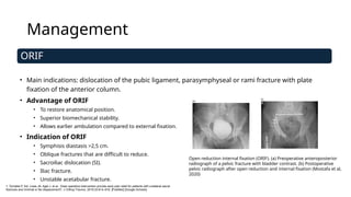PPT CURRENT MANAGEMENT PELVIC FRACTURE edit.pptx