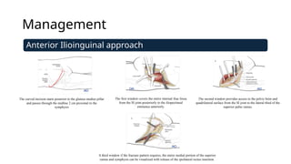 PPT CURRENT MANAGEMENT PELVIC FRACTURE edit.pptx
