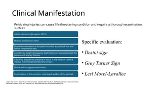 PPT CURRENT MANAGEMENT PELVIC FRACTURE edit.pptx