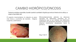 degeneraciones necrosis | PPTX
