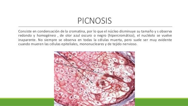 degeneraciones necrosis