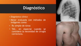 Corrección de Pectus Excavatum | PPTX