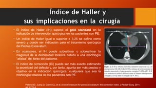 Corrección de Pectus Excavatum | PPTX