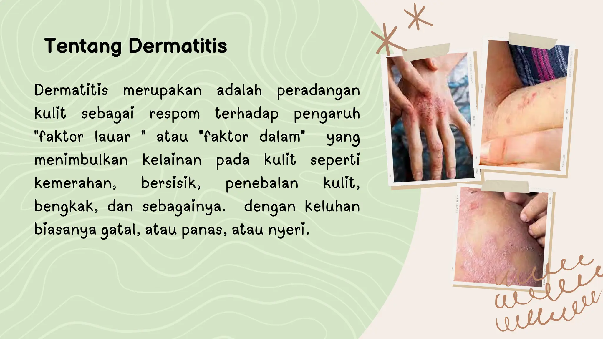 PPT DERMATITIS PKM.pdf
