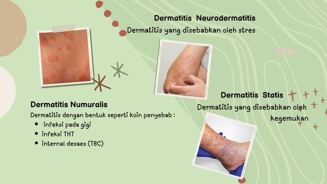 PPT DERMATITIS PKM.pdf