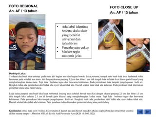 PPT Deskripsi Luka.pptx - | PPTX