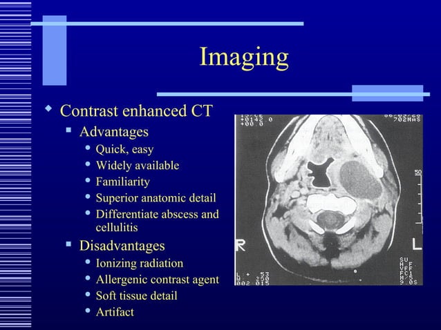 Ppt dhni anat mirvakili | PPT