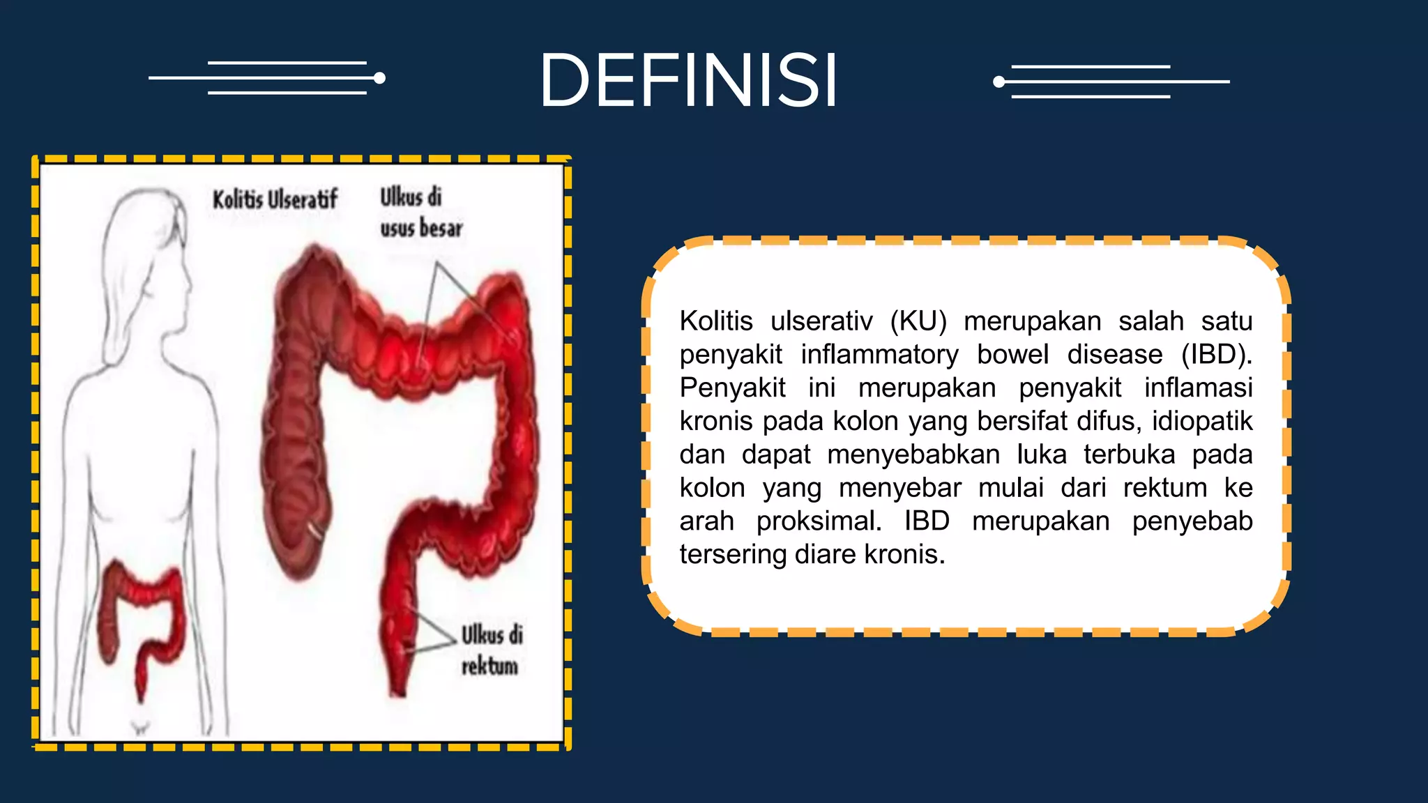PPT Digestive system (Kolitis ulseratif).pptx