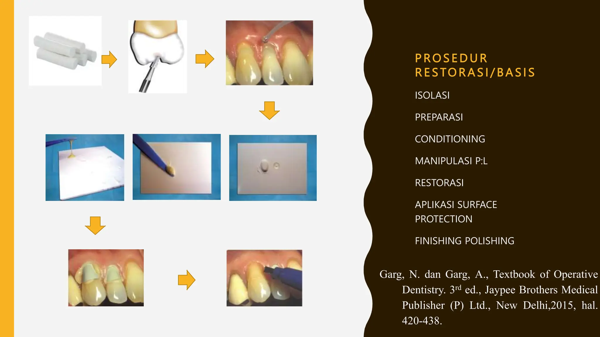 PPT DISKUSI GIC Henaria Mikha Teresa.pptx