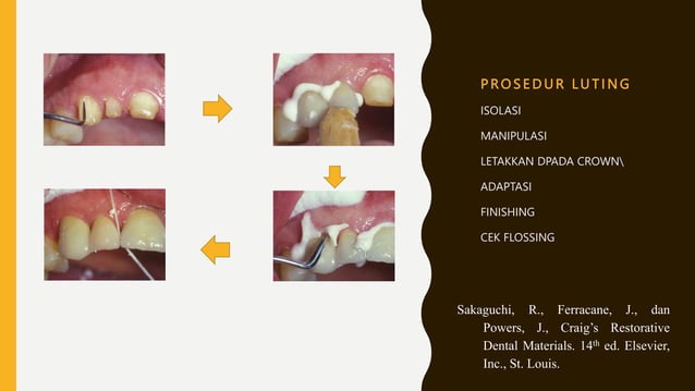 PPT DISKUSI GIC Henaria Mikha Teresa.pptx