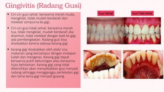 PPT DOKCIL.pptx