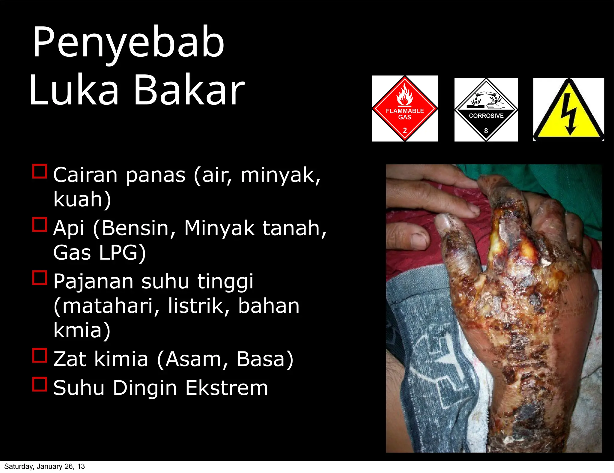 PPT LUKA BAKAR UNTUK MEDIS DAN PARAMEDIS | PPTX