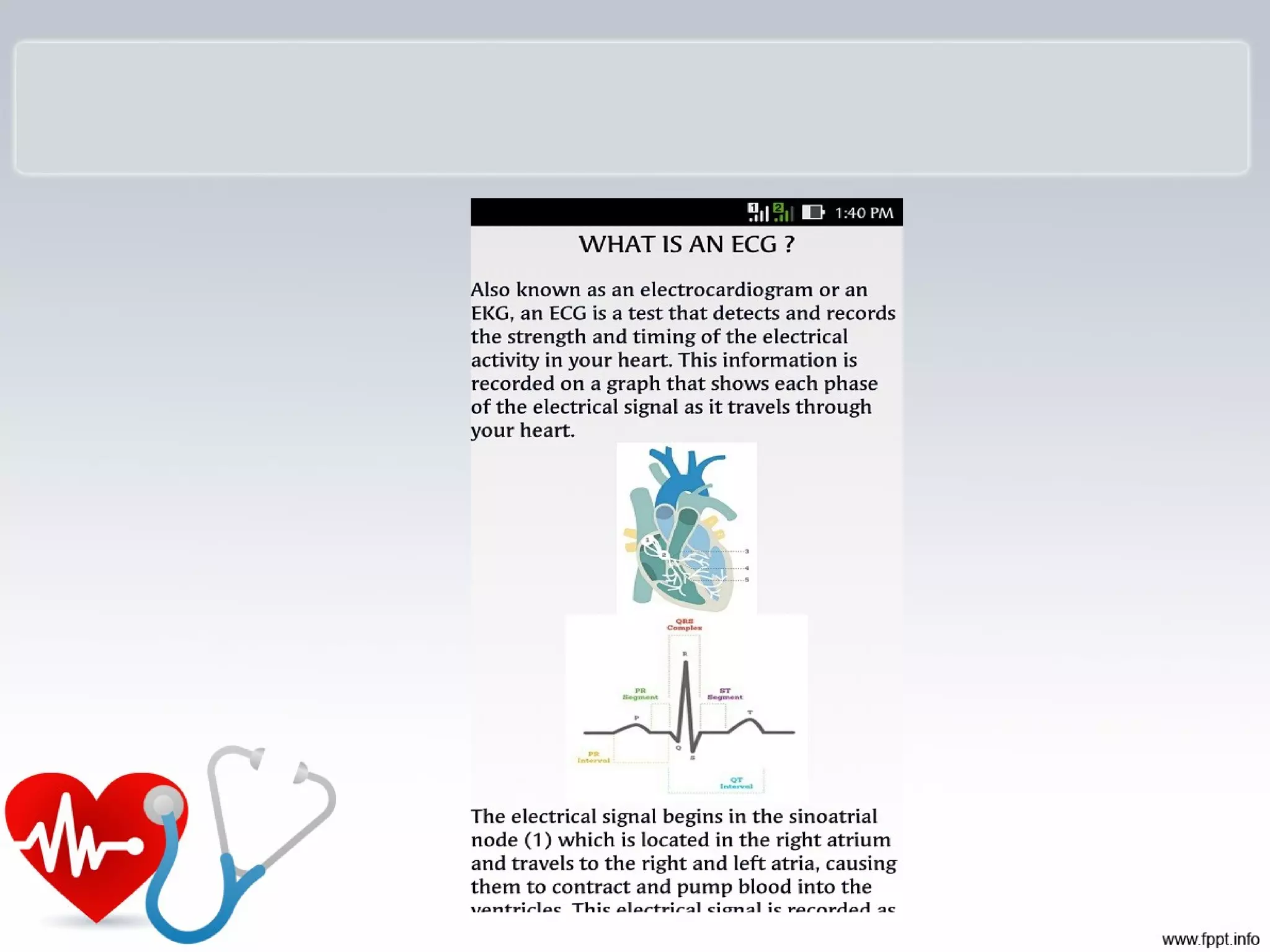 Ecg Monitoring System Ppt