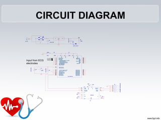 ECG MONITORING SYSTEM | PPT