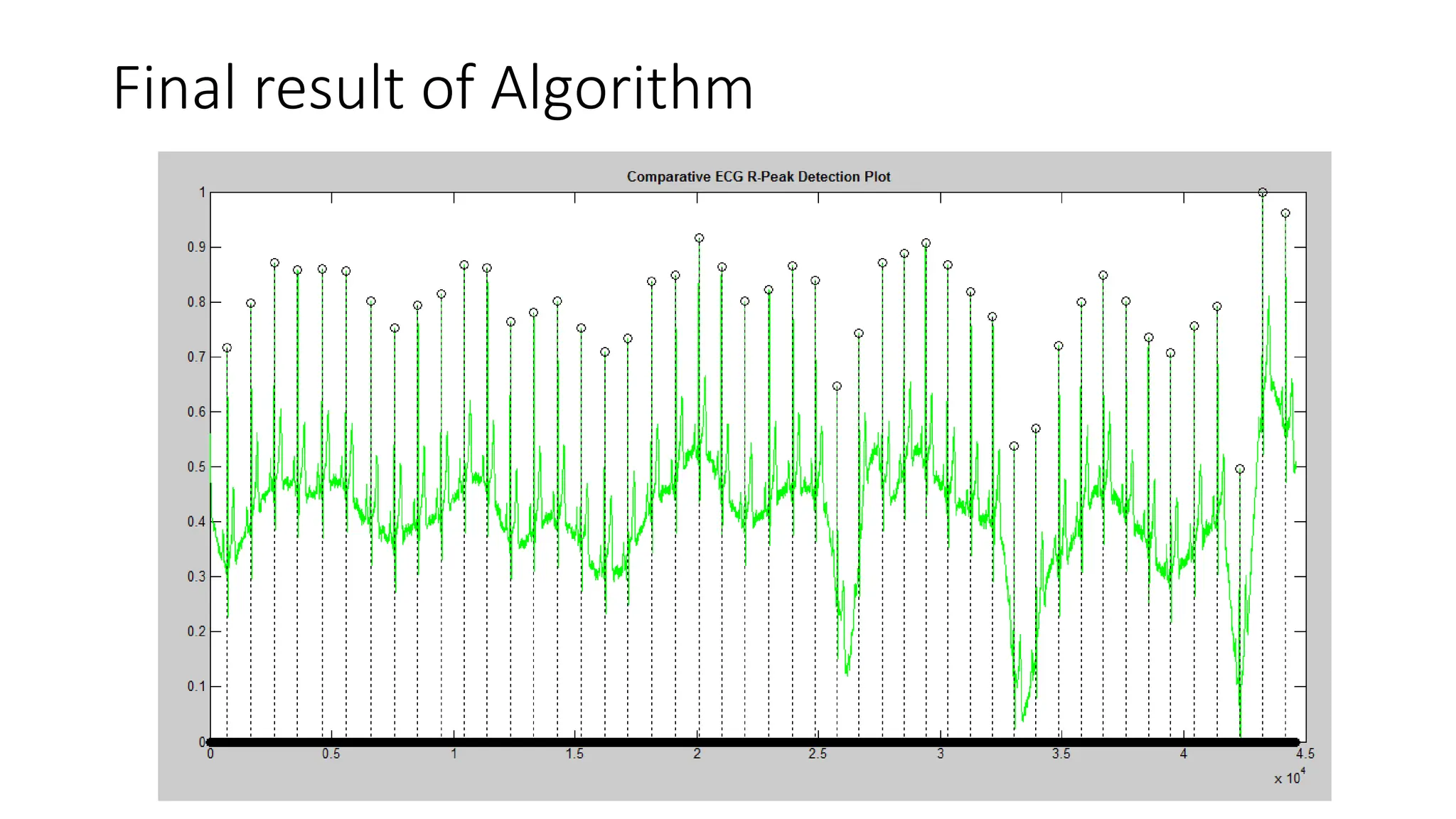 Iot Based Ecg Monitoring System Using Node Mcu Ppt