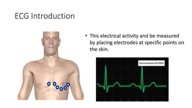 Iot based ECG monitoring system using node mcu | PPT