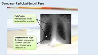 Ppt edema paru referat rifki | PPTX