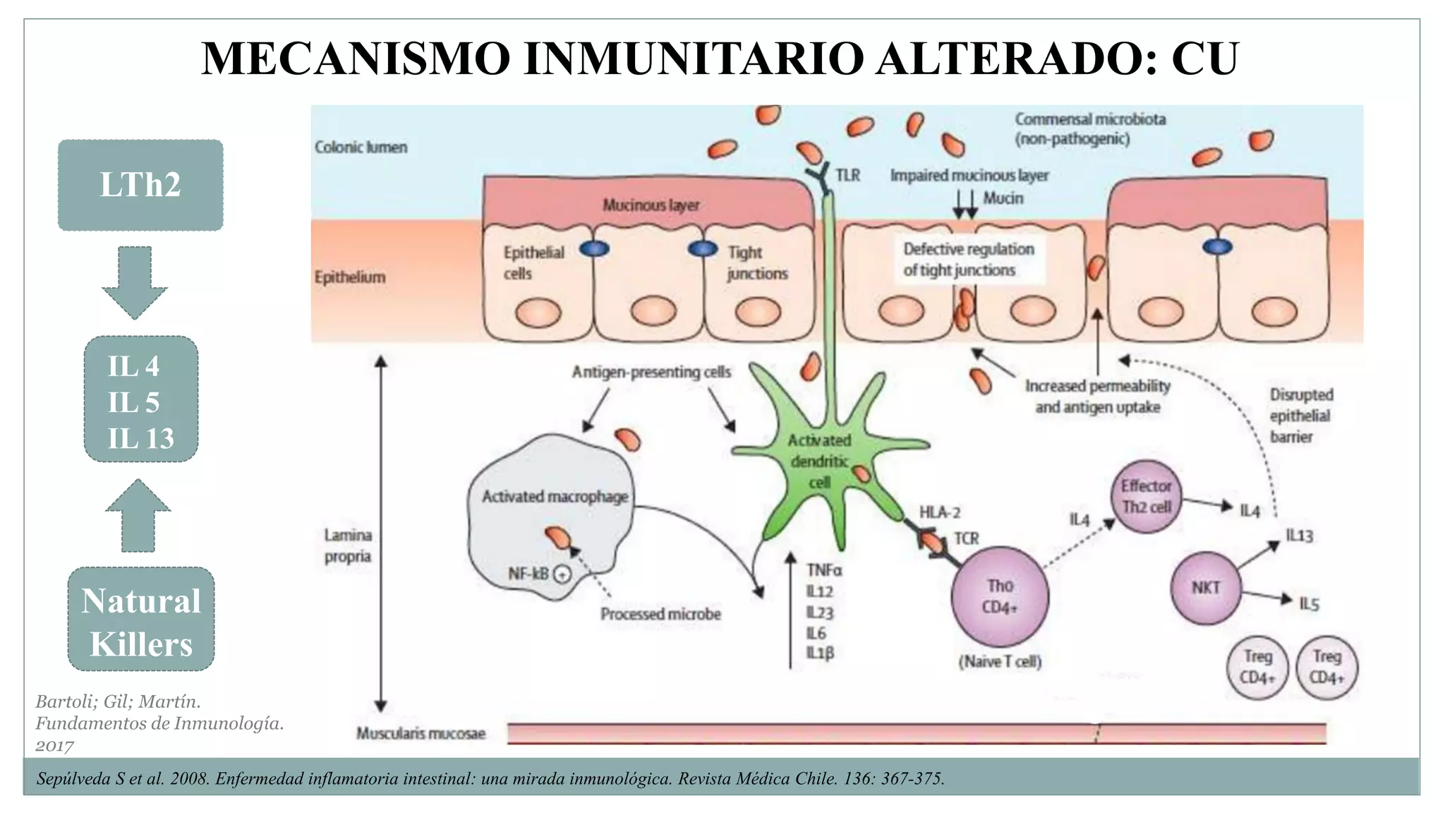 ENFERMEDAD INFLAMATORIA INTESTINAL (EII) ENFERMEDAD DE CROHN (EC ...