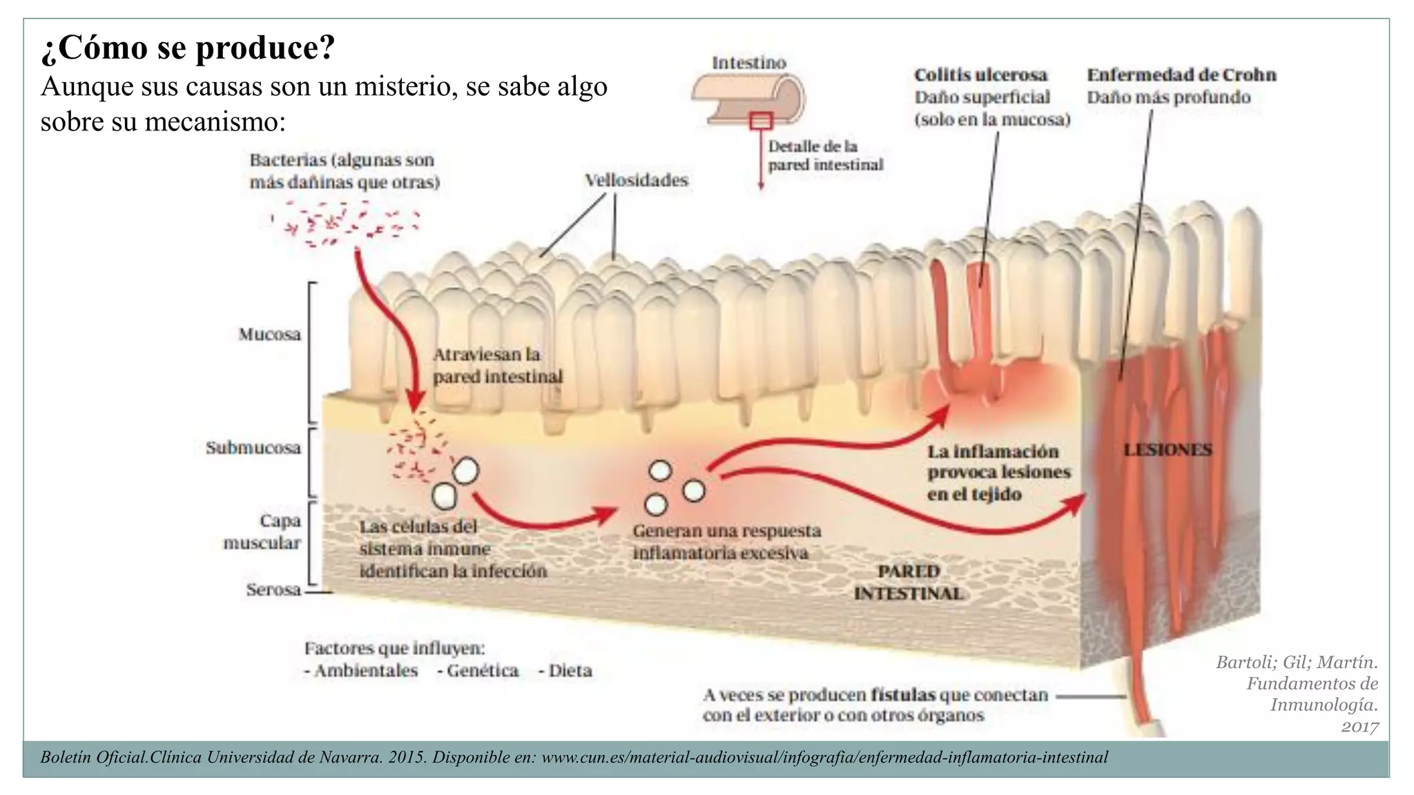 ENFERMEDAD INFLAMATORIA INTESTINAL (EII) ENFERMEDAD DE CROHN (EC ...